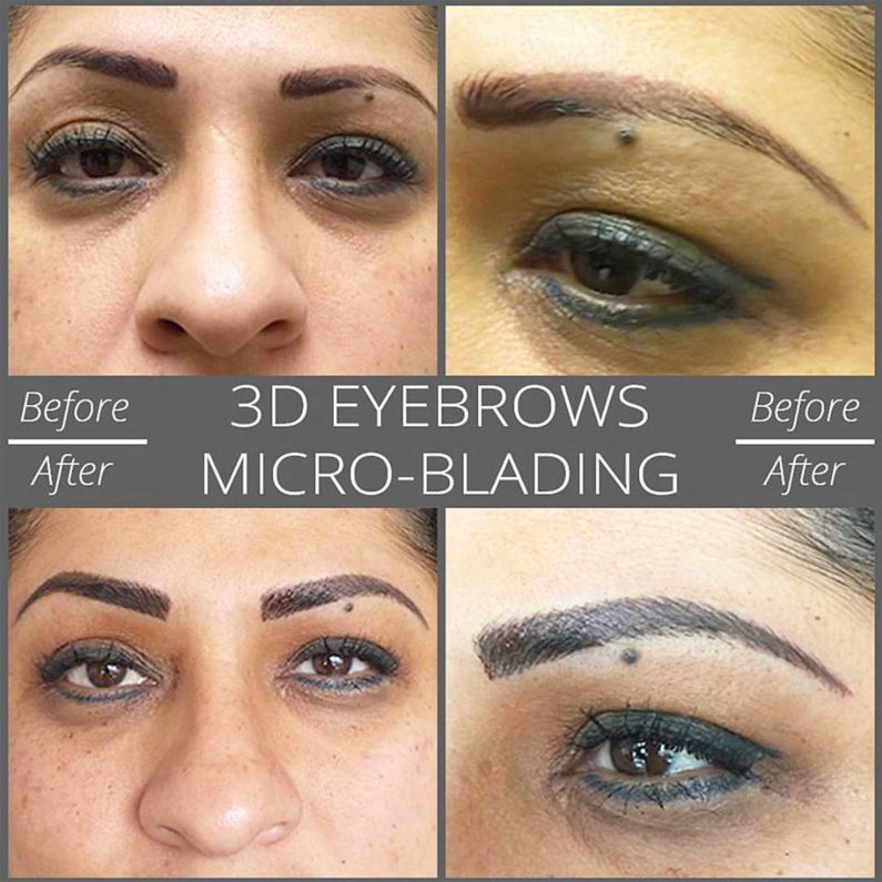 micro-blading Archives | New U Professional Natural Beauty Treatments ...
